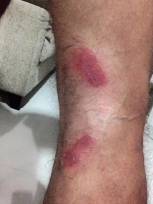 What Is a Tomcat? Bali’s Dangerous Insect Explained - Bali.live